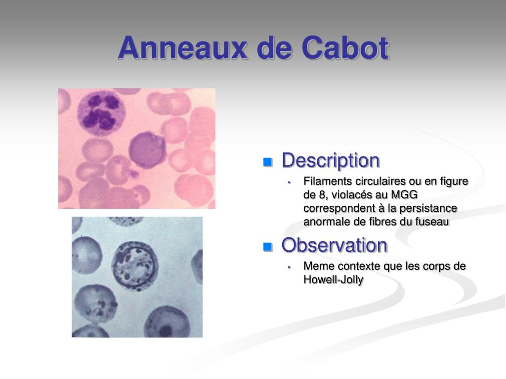 PPT - MORPHOLOGIE DES HEMATIES Normales et Pathologiques Viviane ...