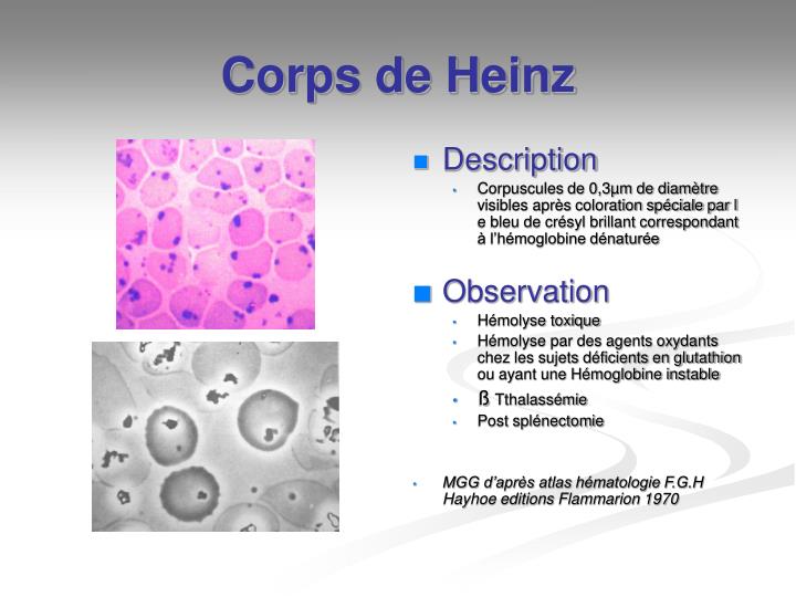 PPT - MORPHOLOGIE DES HEMATIES Normales et Pathologiques Viviane ...