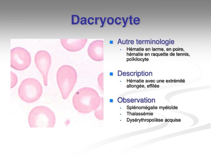 PPT - MORPHOLOGIE DES HEMATIES Normales et Pathologiques Viviane ...