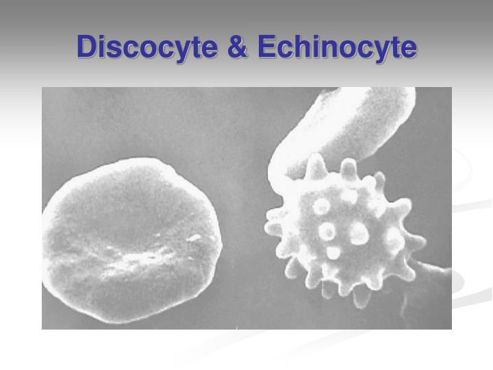 PPT - MORPHOLOGIE DES HEMATIES Normales et Pathologiques Viviane ...