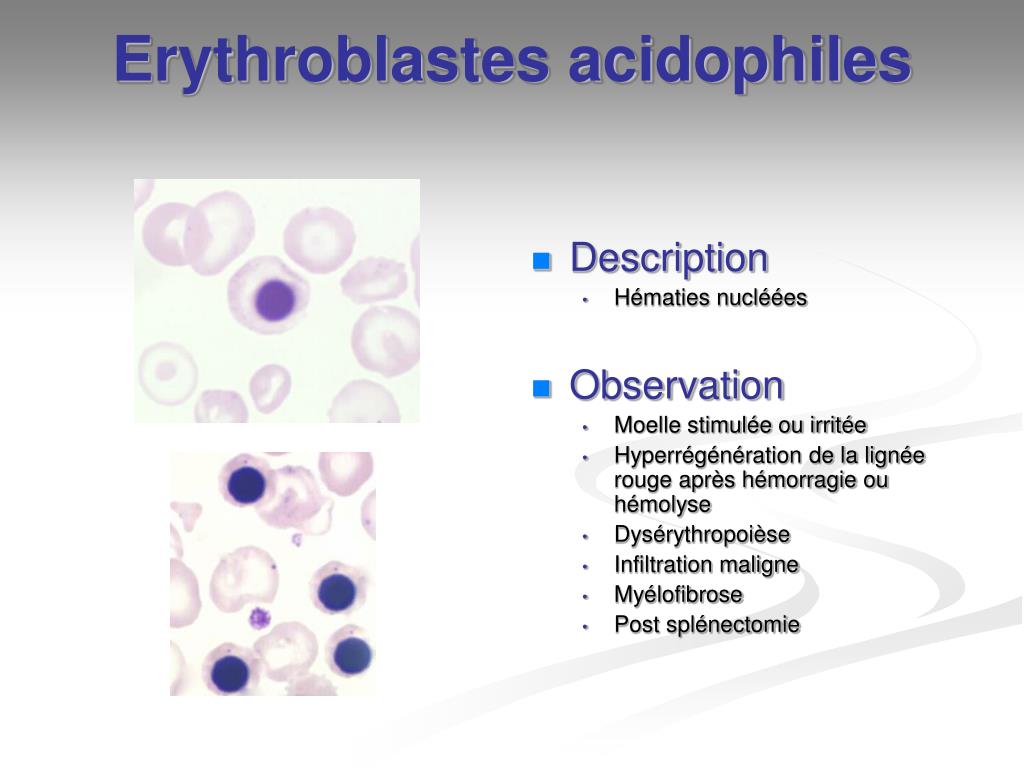 PPT - MORPHOLOGIE DES HEMATIES Normales et Pathologiques Viviane ...