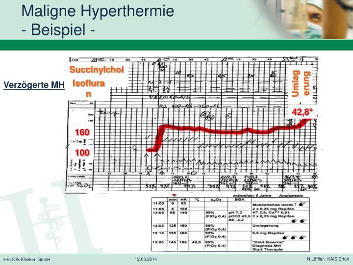 PPT - Maligne Hyperthermie - The Ugly - PowerPoint Presentation - ID:429733