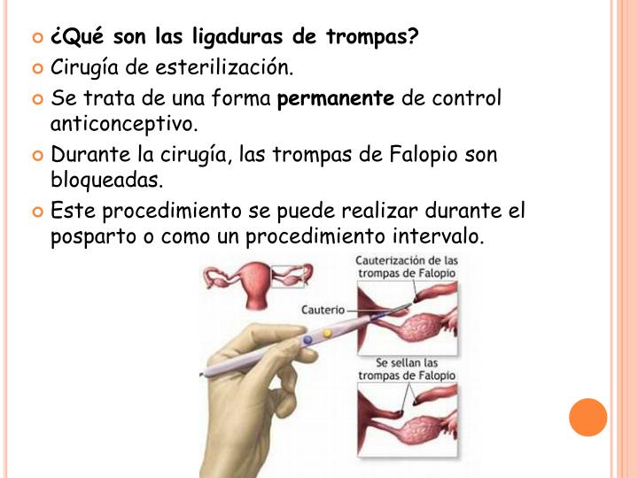 PPT - Ligaduras de trompas PowerPoint Presentation - ID:430862