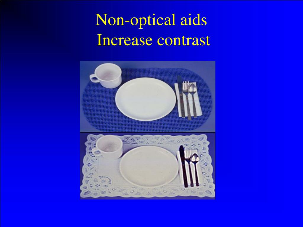 PPT - Low Vision in Older People PowerPoint Presentation, free download ...