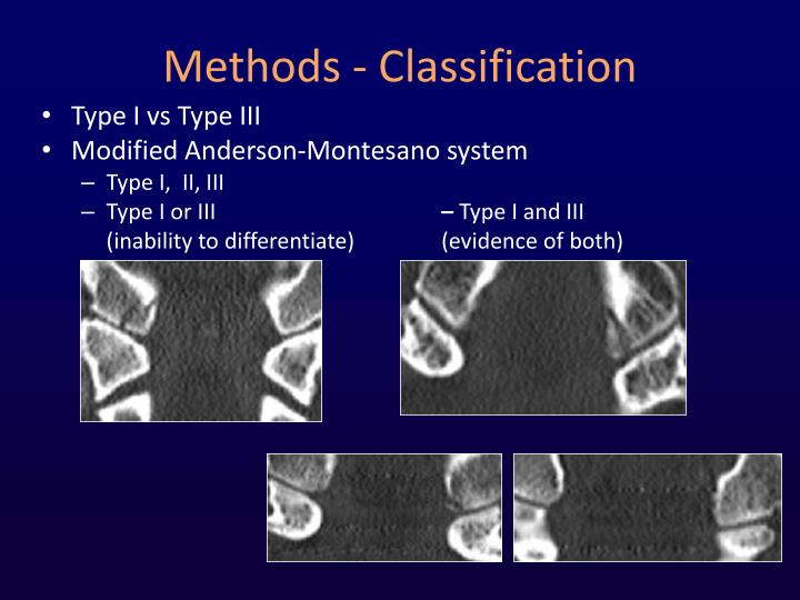 PPT - Occipital Condyle Fractures: Epidemiology, Classification, and ...
