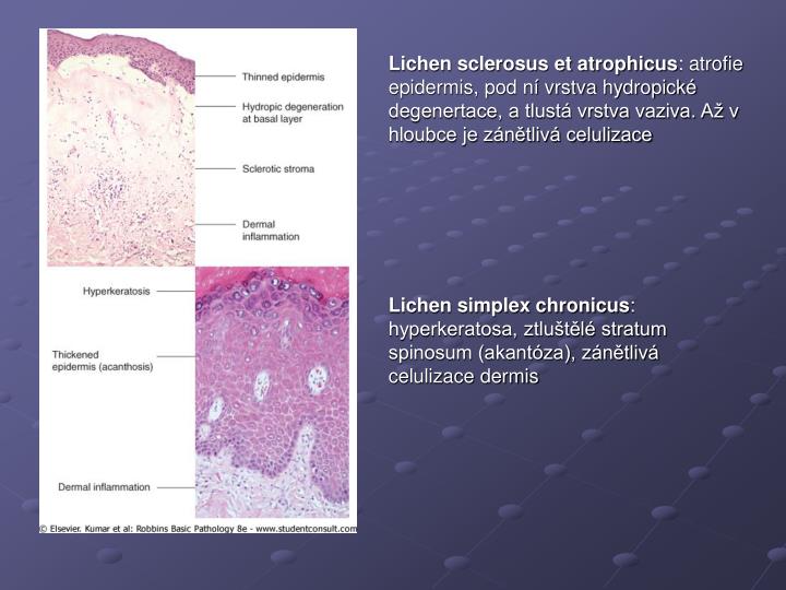 PPT - Gynekopatologie PowerPoint Presentation - ID:433081