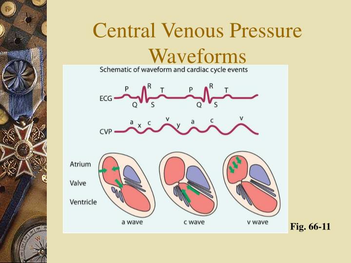 PPT - Hemodynamic Monitoring PowerPoint Presentation - ID:434068