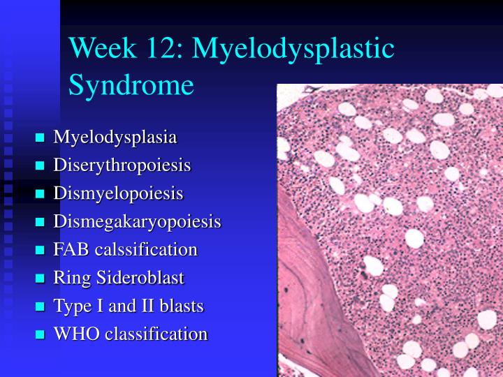 PPT - Week 12: Myelodysplastic Syndrome PowerPoint Presentation, free ...