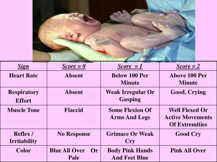 PPT - Modified Glascow Coma Scale for Infants and Children PowerPoint ...