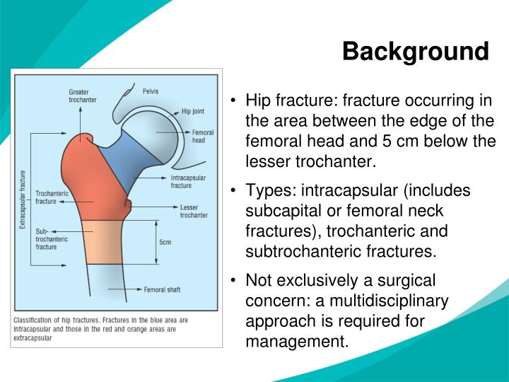 PPT - Hip fracture PowerPoint Presentation - ID:441934