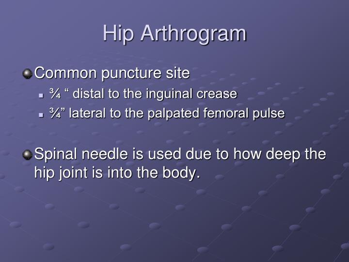 PPT - Arthrography PowerPoint Presentation - ID:443478