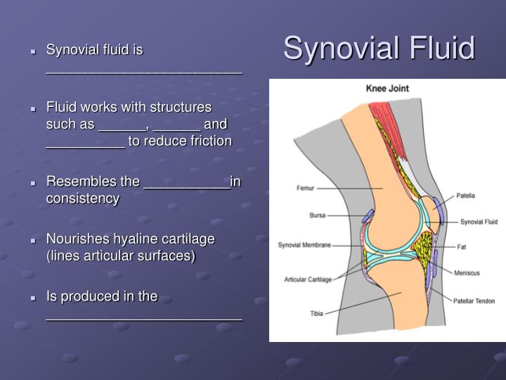 PPT - Arthrography PowerPoint Presentation - ID:443478
