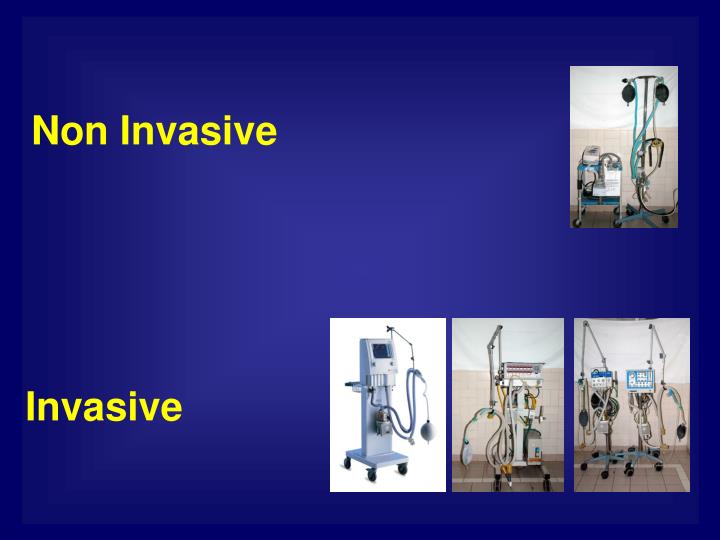 PPT - Mechanical Ventilation PowerPoint Presentation - ID:444490