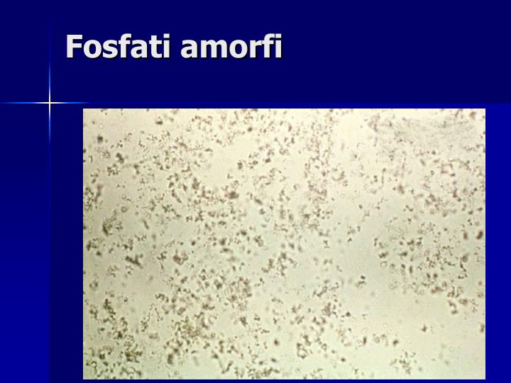 PPT - Esame delle urine PowerPoint Presentation - ID:445594