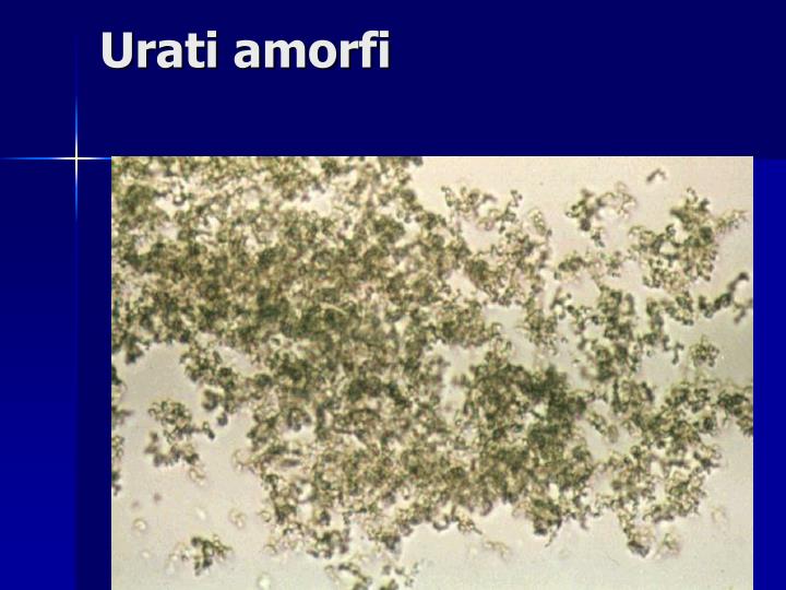 PPT - Esame delle urine PowerPoint Presentation - ID:445594