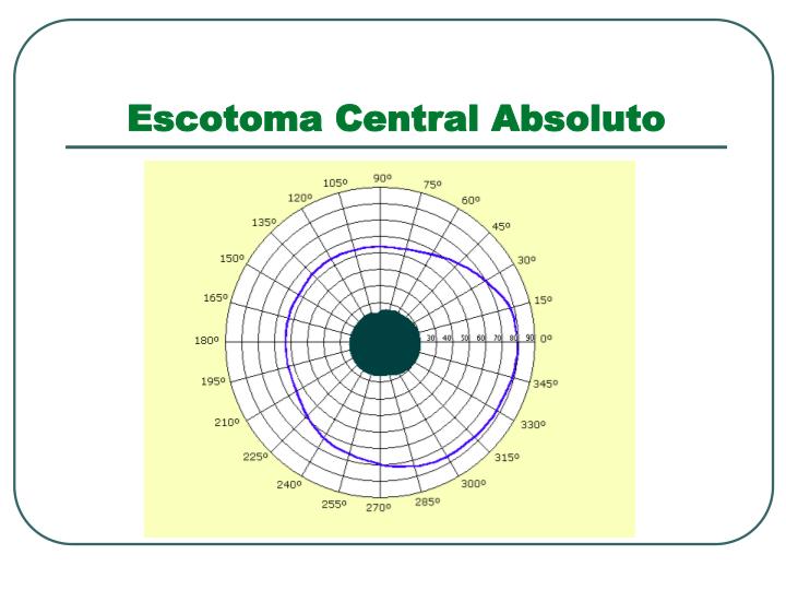 PPT - LA VISIÓN. ASPECTOS BÁSICOS PowerPoint Presentation - ID:445986