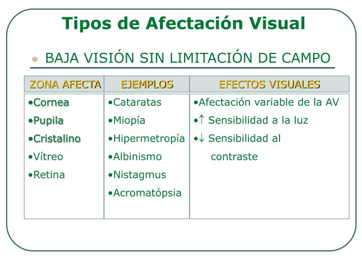 PPT - LA VISIÓN. ASPECTOS BÁSICOS PowerPoint Presentation - ID:445986