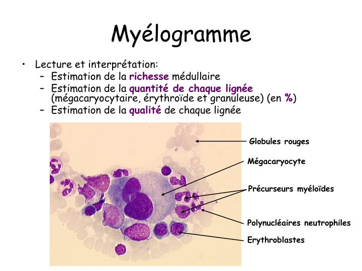PPT - Myélogramme et Biopsie Ostéo-Médullaire PowerPoint Presentation ...