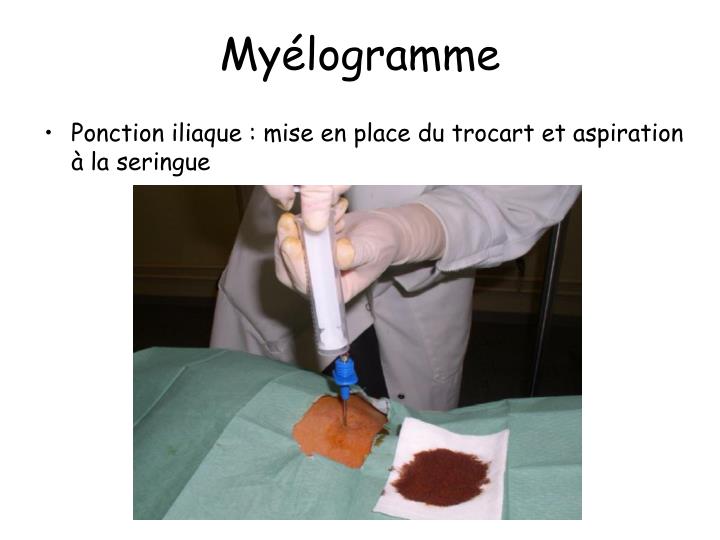 PPT - Myélogramme et Biopsie Ostéo-Médullaire PowerPoint Presentation ...