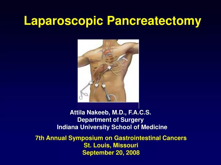 PPT - Laparoscopic Pancreatectomy PowerPoint Presentation, free ...