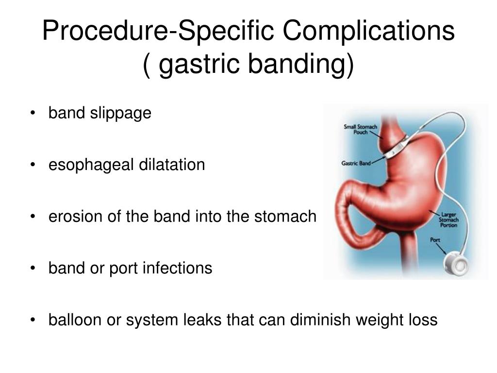 PPT - Post-Surgical Care of the Bariatric Patient PowerPoint ...