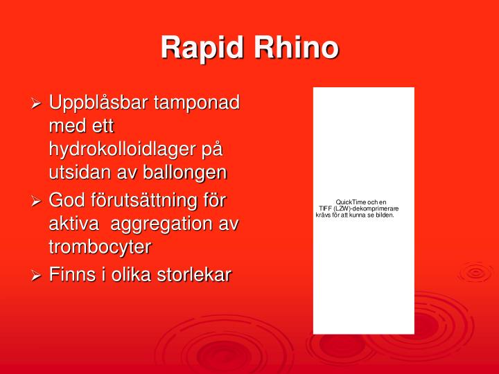 PPT - Näsblödning/Epistaxis PowerPoint Presentation - ID:450915