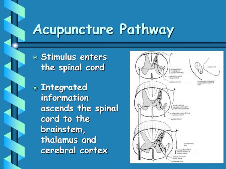 PPT - Acupuncture Part 1 PowerPoint Presentation - ID:45152