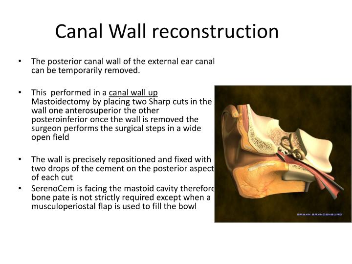PPT - Middle Ear Cement PowerPoint Presentation - ID:452133
