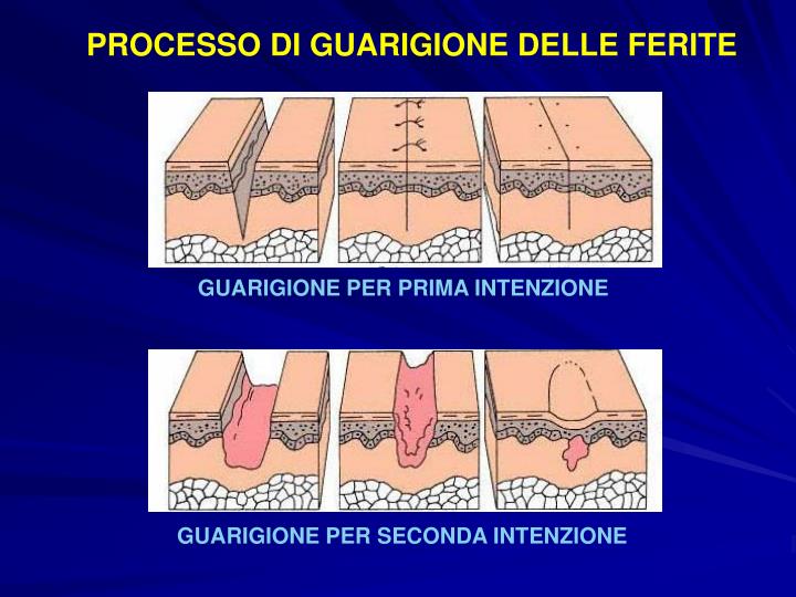 PPT - LE FERITE PowerPoint Presentation - ID:453288