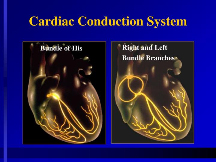 PPT - Principles of Cardiac Pacing PowerPoint Presentation - ID:454515