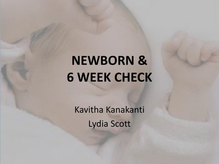 PPT - NEWBORN & 6 WEEK CHECK PowerPoint Presentation, free download ...