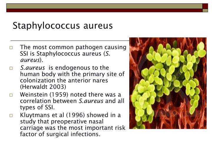 PPT - Preoperative Staphylococcus aureus Nasal Screening: Impact on ...