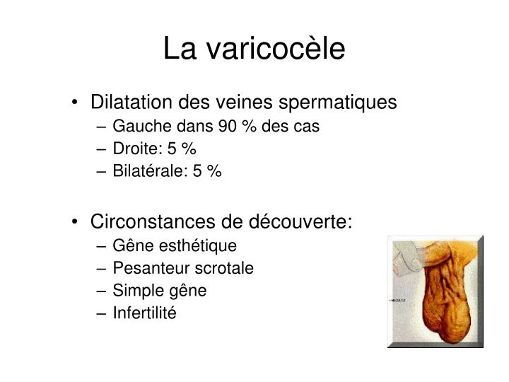 PPT - Pathologies génito-scrotales PowerPoint Presentation - ID:456010