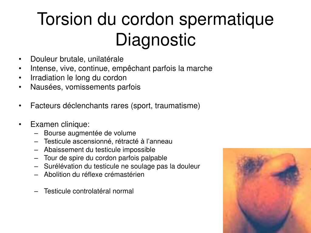 Ppt Pathologies Génito Scrotales Powerpoint Presentation Id 456010