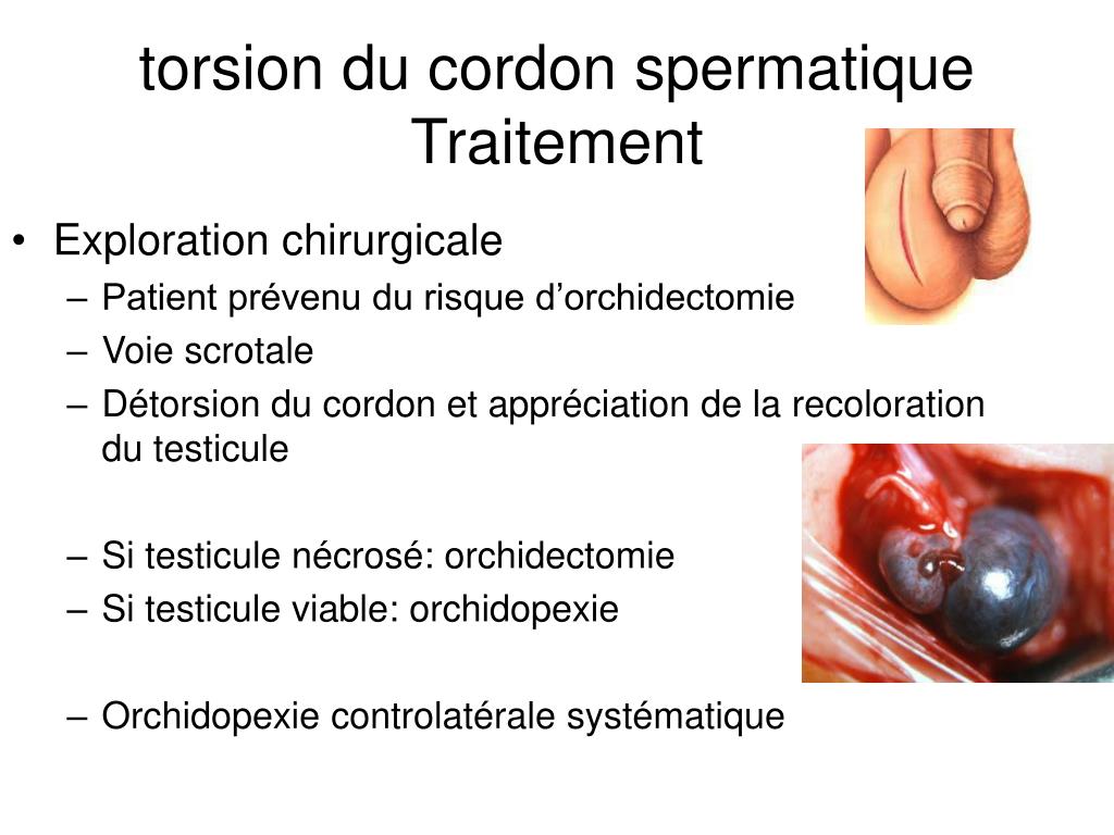 Ppt Pathologies Génito Scrotales Powerpoint Presentation Id 456010