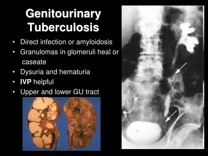 PPT - Tina Kennelly December 17, 2008 PowerPoint Presentation - ID:456577