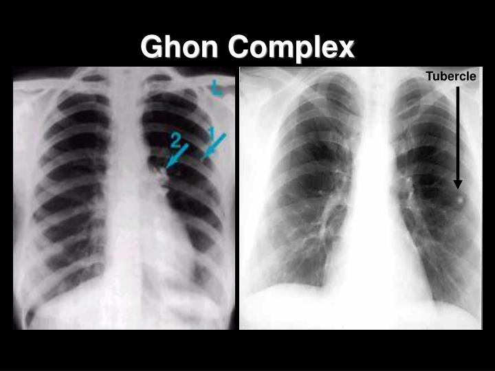 PPT - Tina Kennelly December 17, 2008 PowerPoint Presentation - ID:456577