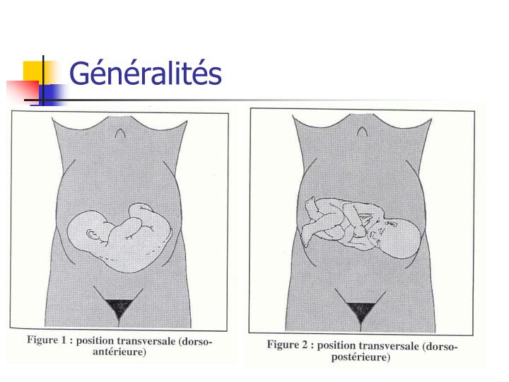 PPT - Positions transversales et obliques PowerPoint Presentation - ID:456748