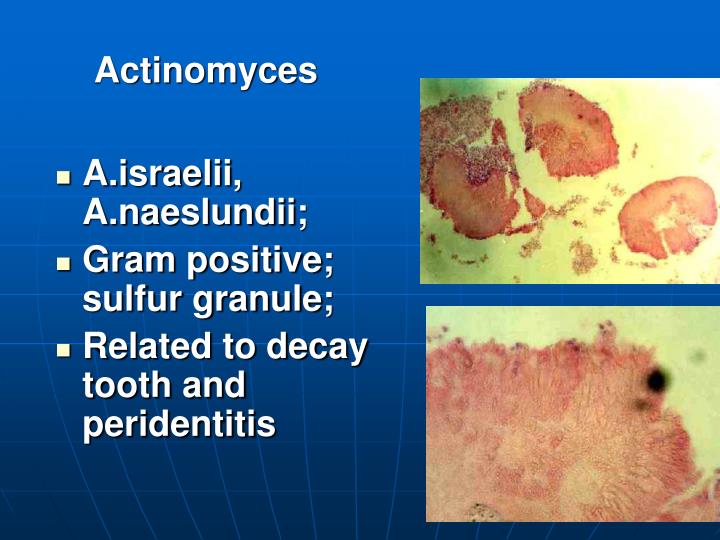 PPT - Actinomyces & Nocardia PowerPoint Presentation - ID:464498