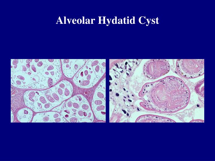 PPT - Echinococcus granulosus PowerPoint Presentation - ID:465018