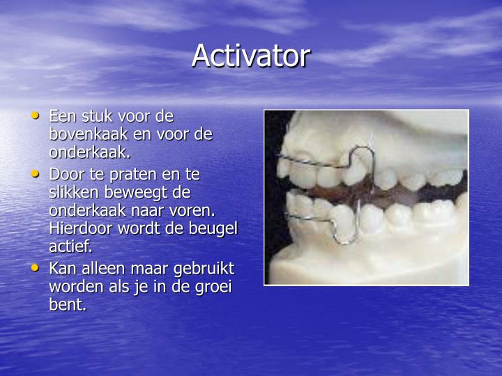 PPT - De Orthodontist PowerPoint Presentation - ID:466623