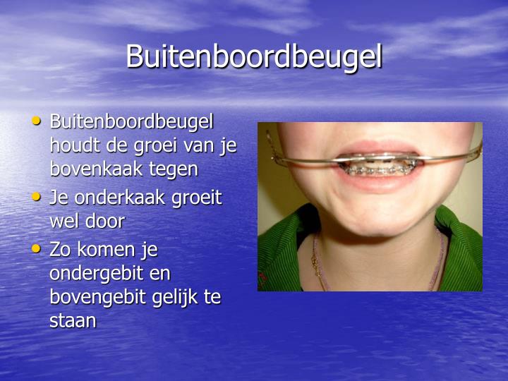 PPT - De Orthodontist PowerPoint Presentation - ID:466623