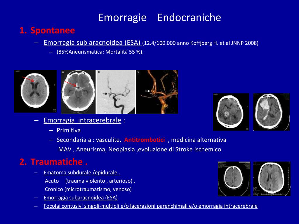 PPT - Il paziente emorragico in TAO Definizione di Protocolli ...
