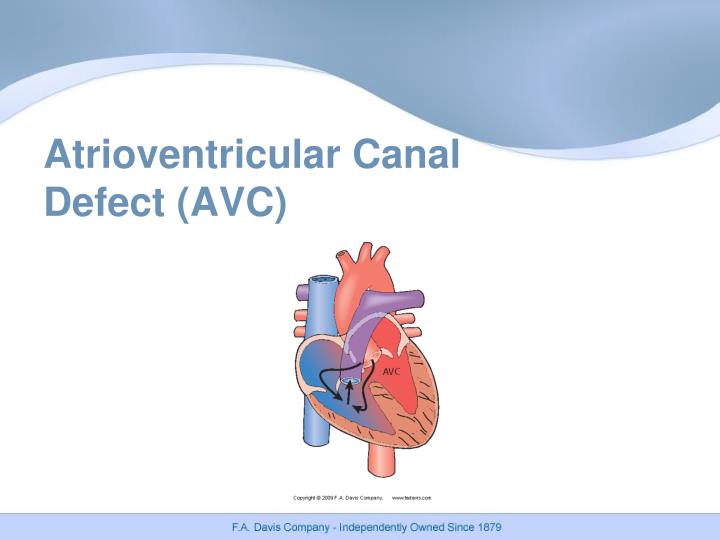 PPT - Chapter 27 PowerPoint Presentation - ID:472103