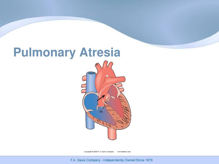 PPT - Chapter 27 PowerPoint Presentation - ID:472103