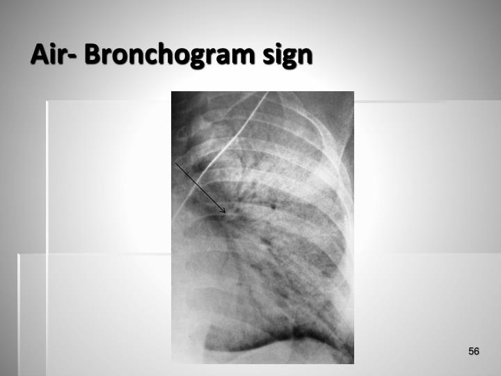 PPT - Respiratory System PowerPoint Presentation - ID:473560