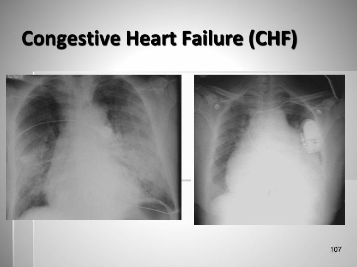 PPT - Respiratory System PowerPoint Presentation - ID:473560