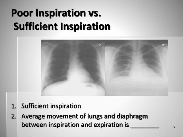 PPT - Respiratory System PowerPoint Presentation - ID:473560