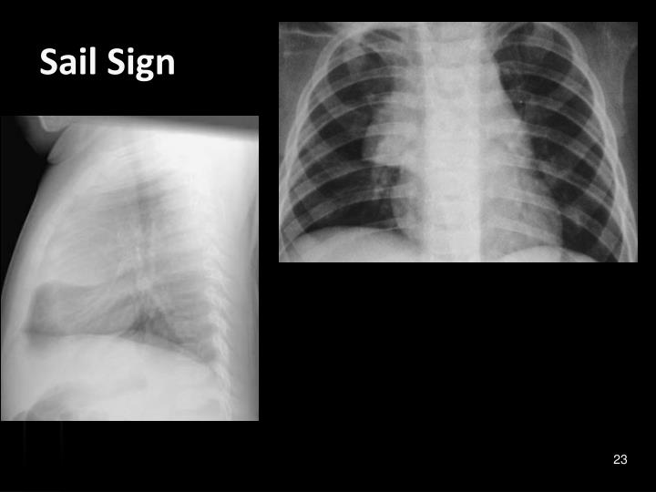 PPT - Respiratory System PowerPoint Presentation - ID:473560