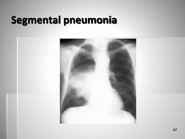 PPT - Respiratory System PowerPoint Presentation - ID:473560